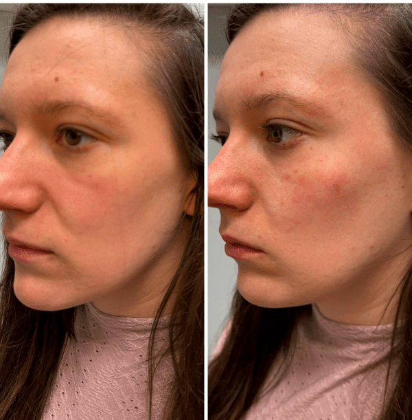 Specialty MedSpa and Wellness: MedSpa in The Colony, TX